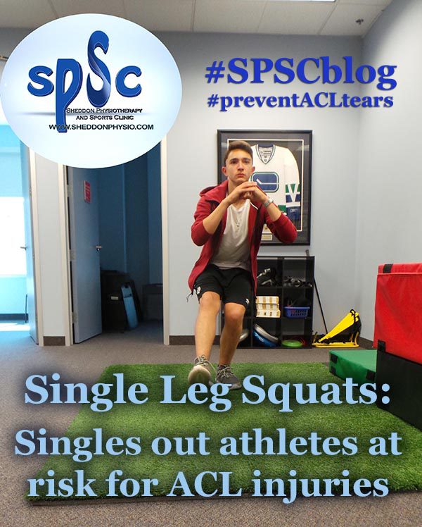 Single Leg Squats: Singles out athletes at risk for ACL injuries